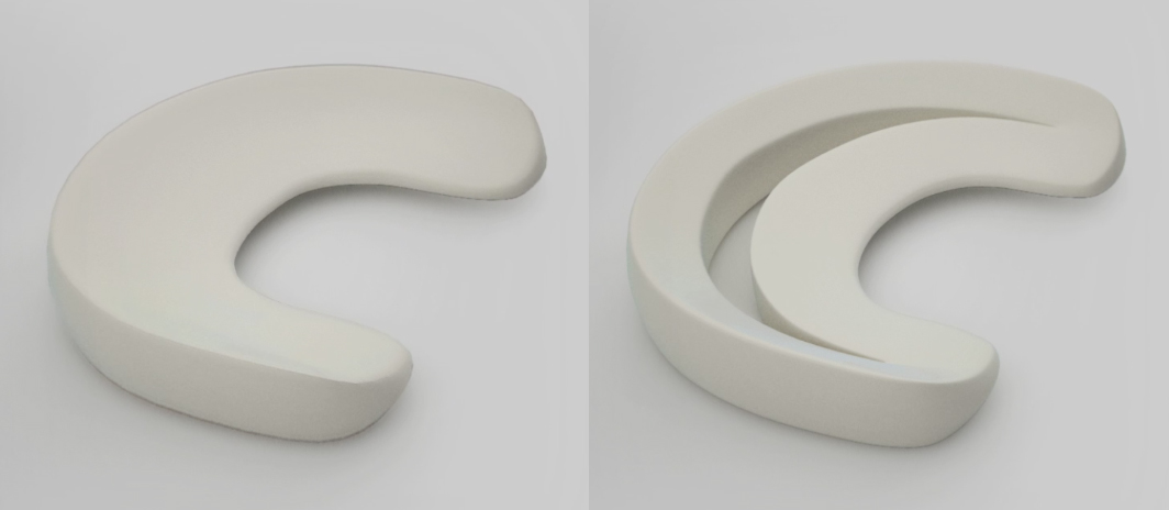 Pathologie - GENOU - Ménisque